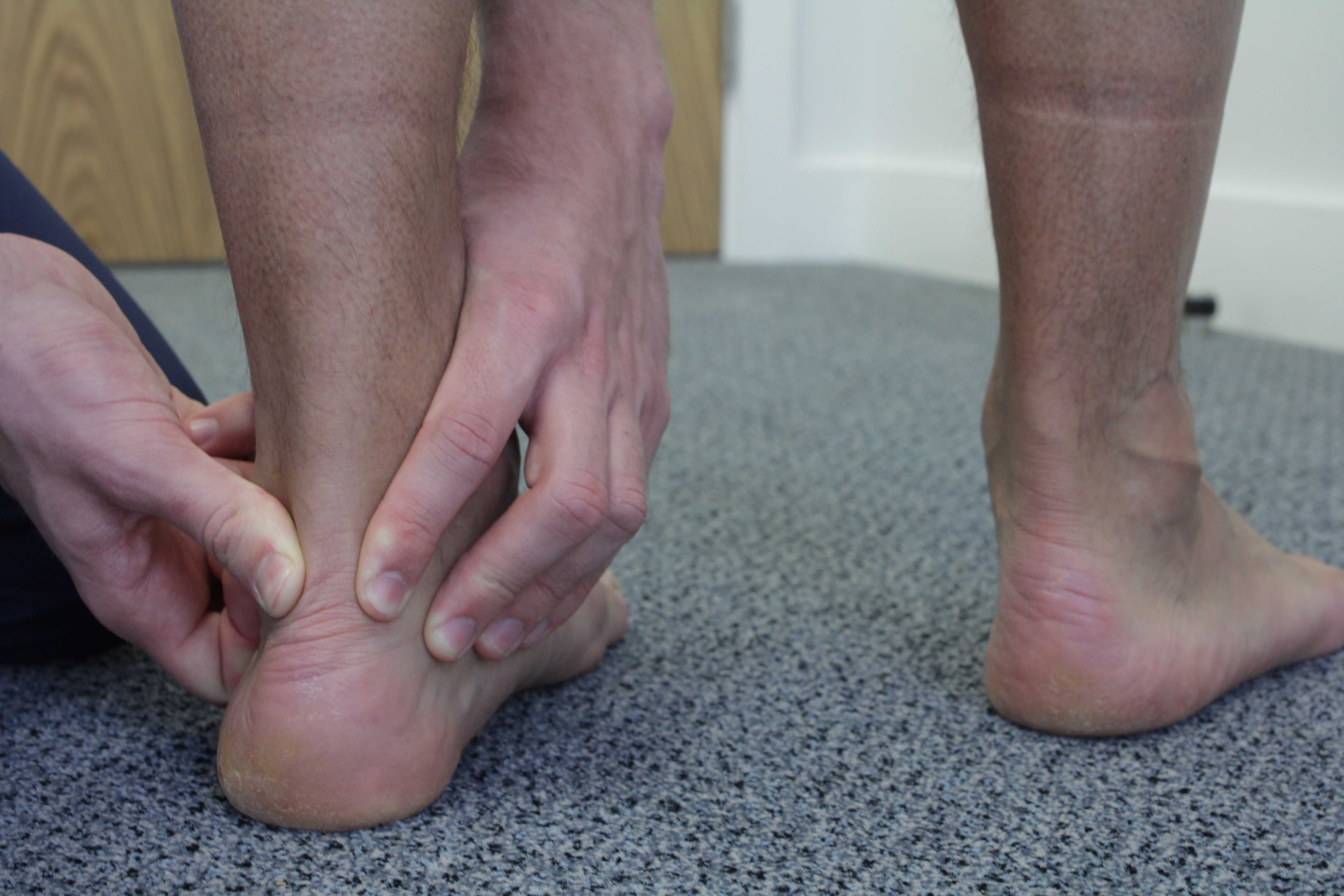 Ankle achilles tendon rupture Musculoskeletal What we treat